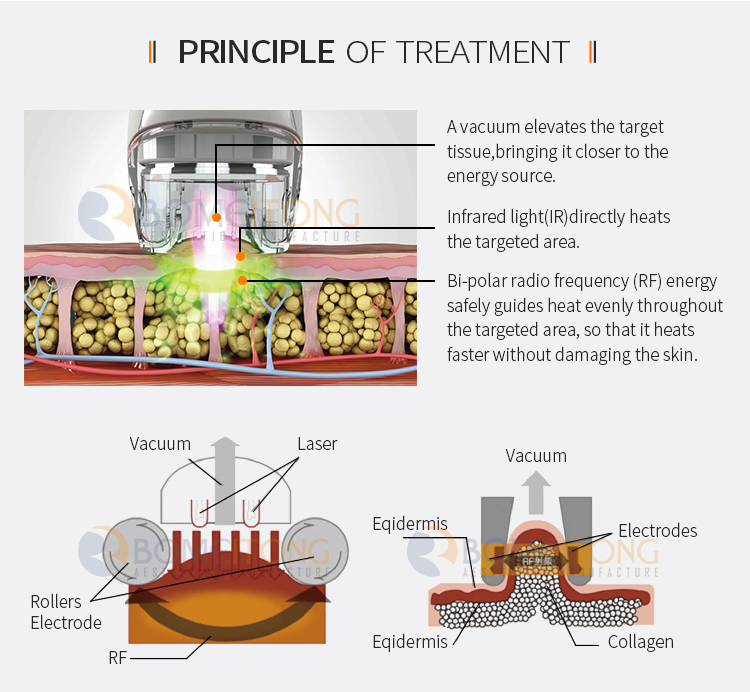 Body Contouring Machine RF&Cavitation&Vacuum Cellu Shape Pro Magic ...