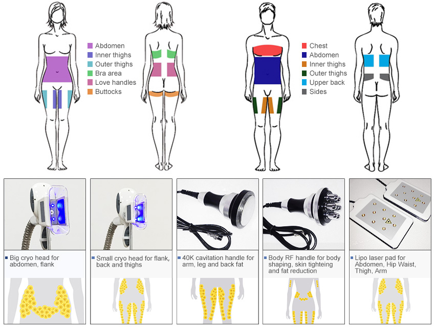 Lower back fat removal cryolipolysis machine cavitation lipo laser ...